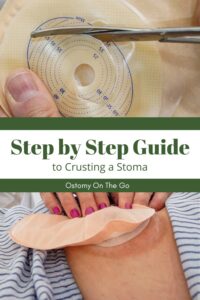 Stoma Crusting Technique: Step by Step Guide - Ostomyonthego
